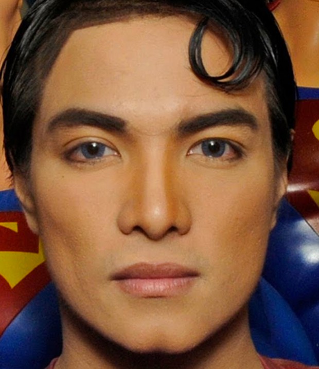 Herbert Chávez, un filipino de 39 años que se ha operado 26 veces para ...